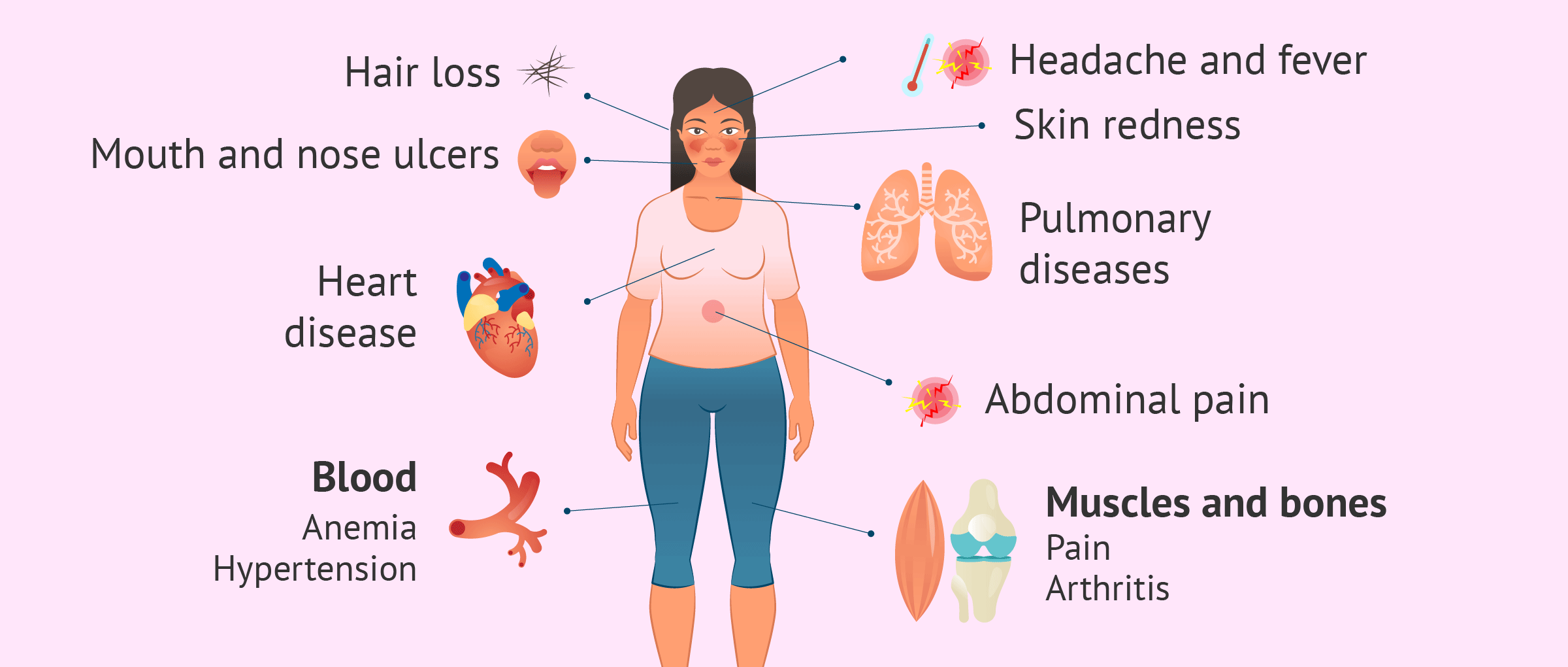 Apa Saja Tanda dan Gejala Lupus? – Kompendium Lupus Indonesia